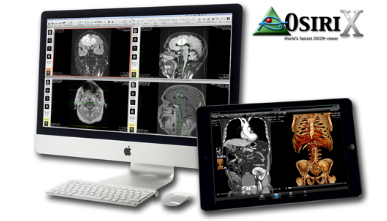 OsiriXを中心とする画像ネットワーク (PACS) - 尾路医科器械株式会社